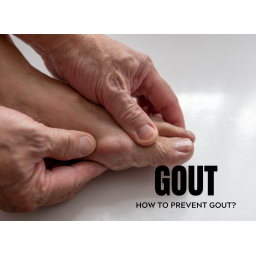 How to Prevent Gout: A Comprehensive Guide